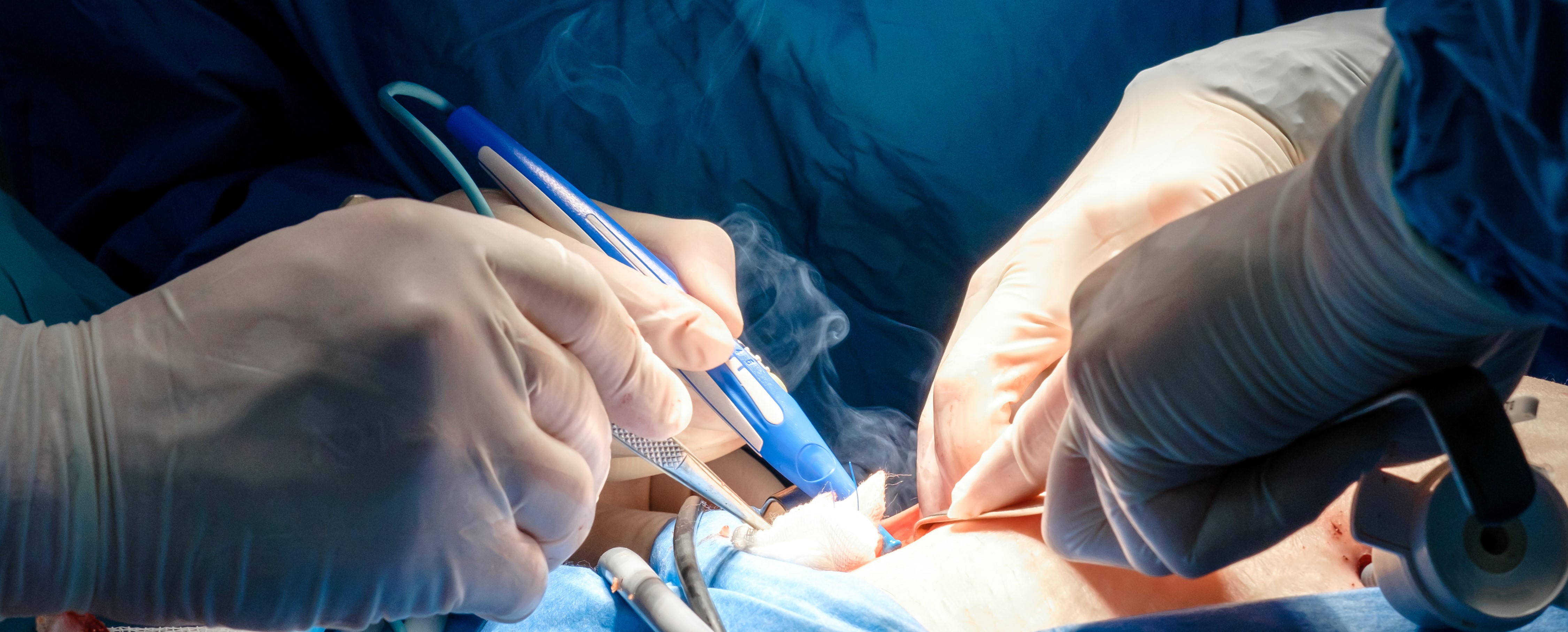 IAP08 - Electrosurgery (Diathermy) – An Introduction - iLearn